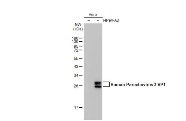 Human Parechovirus Type 1/3 VP1 Recombinant Rabbit Monoclonal Antibody ...