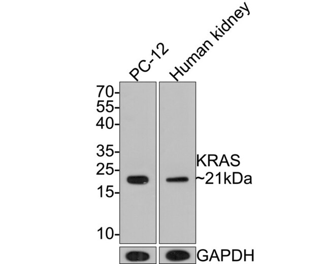 K-Ras Monoclonal Antibody (A8E4), Invitrogen 100 μL, Unconjugated:Antibodies, | Fisher Scientific
