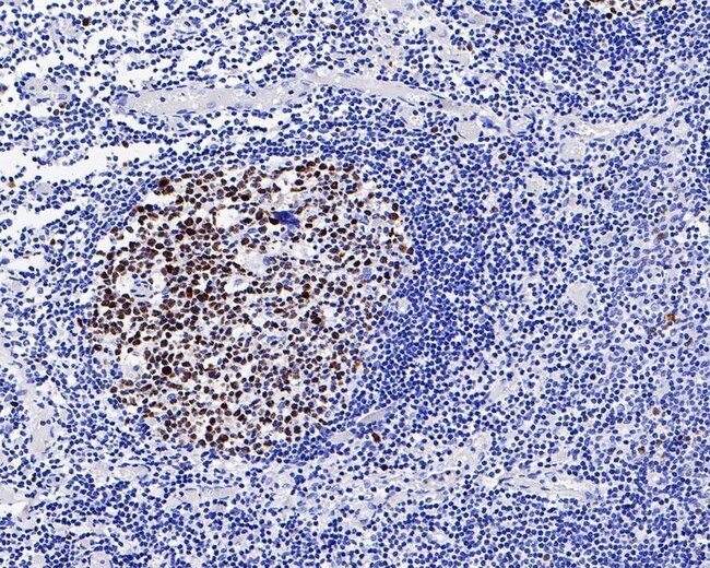 Ki-67 Recombinant Mouse Monoclonal Antibody (PD00-10), Invitrogen 100 ...