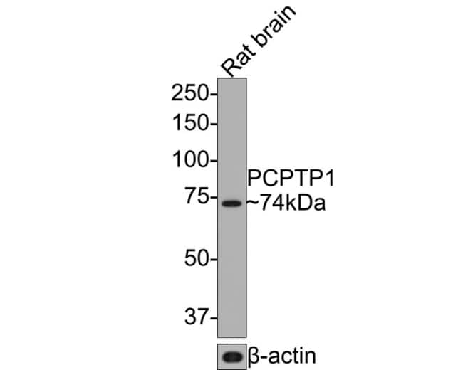 PCPTP1 Recombinant Rabbit Monoclonal Antibody (JE64-84), Invitrogen 100 | Fisher Scientific