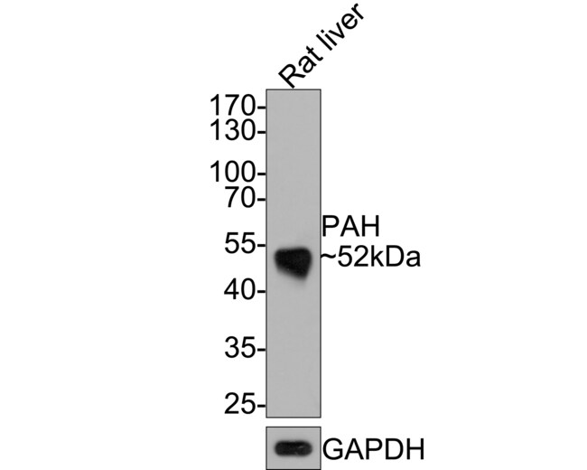 PAH Recombinant Rabbit Monoclonal Antibody (JE64-47), Invitrogen 100 μL ...