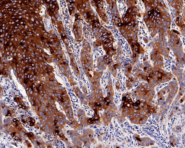 Invitrogen SSEA1 Recombinant Rabbit Monoclonal Antibody (PD00-42) 100 ...