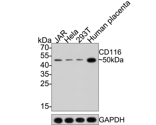 CD116 Recombinant Rabbit Monoclonal Antibody (JE61-37), Invitrogen 100 ...