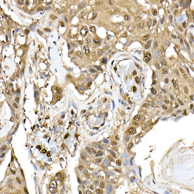 Invitrogen ERK1/ERK2 Recombinant Rabbit Monoclonal Antibody (9H6G8) 100 | Fisher Scientific