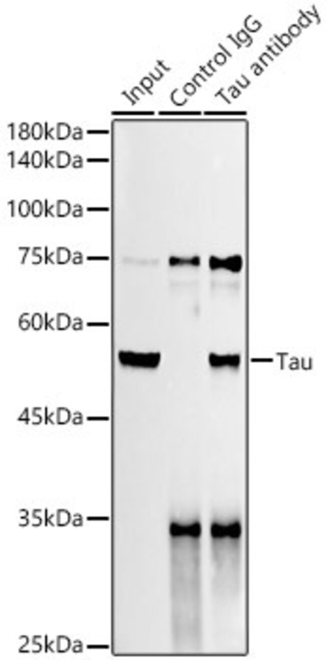 Invitrogen Tau Recombinant Rabbit Monoclonal Antibody (7V8Y7) 100 μL ...