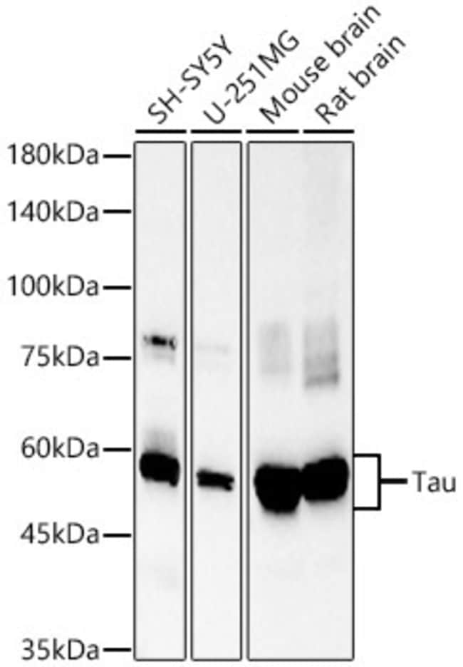 Invitrogen Tau Recombinant Rabbit Monoclonal Antibody (7V8Y7) 100 μL ...