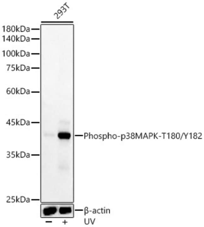 Phospho-p38 MAPK (Thr180, Tyr182) Recombinant Rabbit Monoclonal Antibody | Fisher Scientific