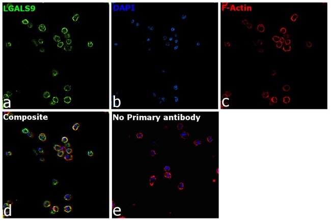 Invitrogen Galectin 9 Recombinant Rabbit Monoclonal Antibody (PSH02-45 ...