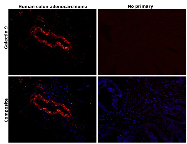 Invitrogen Galectin 9 Recombinant Rabbit Monoclonal Antibody (PSH02-45 ...