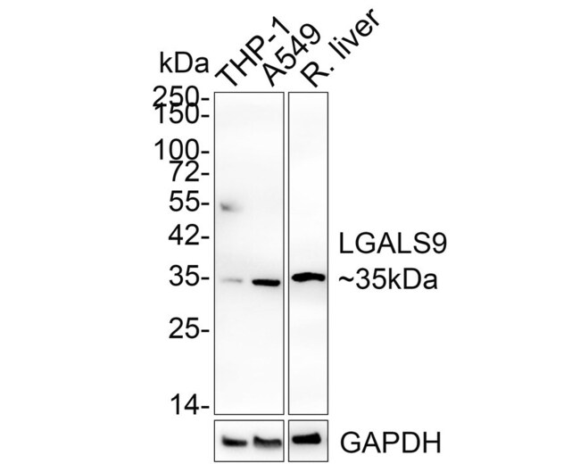 Invitrogen Galectin 9 Recombinant Rabbit Monoclonal Antibody (PSH02-45 ...