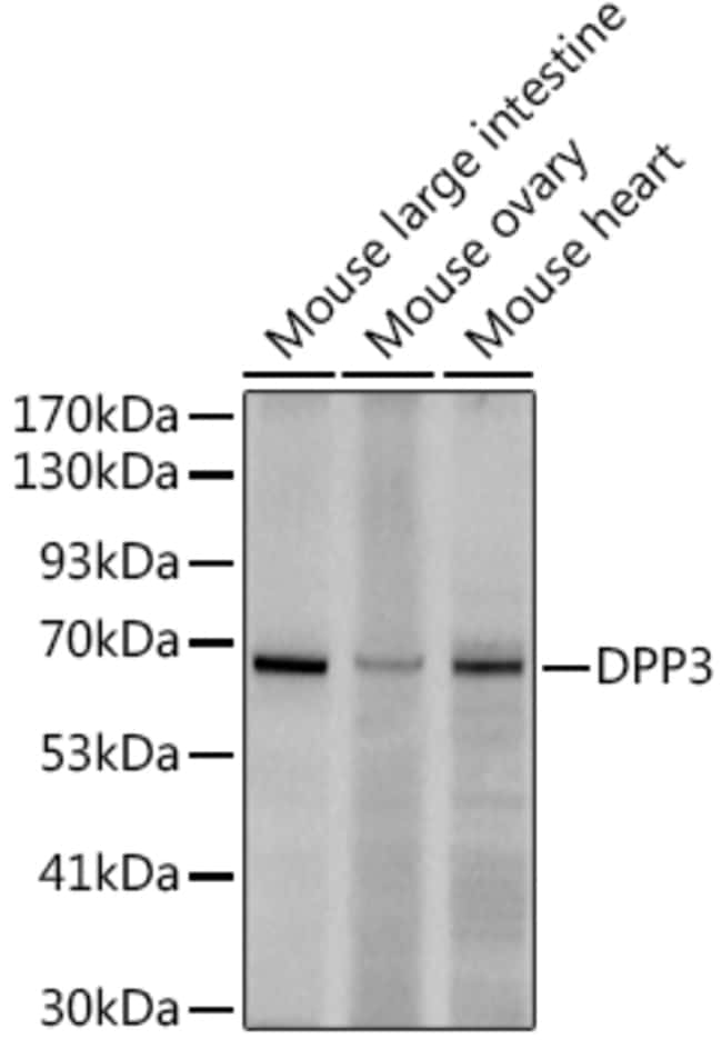 Invitrogen DPP3 Recombinant Rabbit Monoclonal Antibody (6U3A3) 100 μL ...