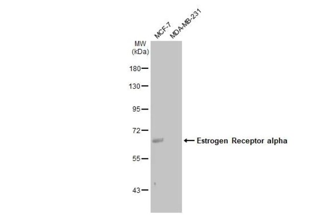 Invitrogen Estrogen Receptor alpha Recombinant Rabbit Monoclonal ...