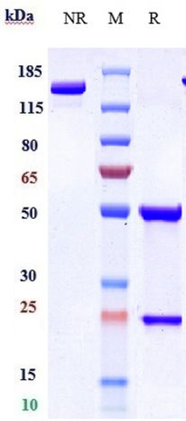 Invitrogen Brodalumab Recombinant Monoclonal Antibody 100 μg; Unconjugated:Anticuerpos | Fisher ...