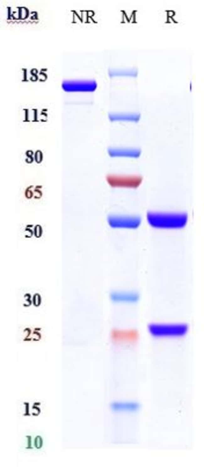 Invitrogen beta Amyloid Biosimilar Recombinant Monoclonal Antibody 1 mg; | Fisher Scientific