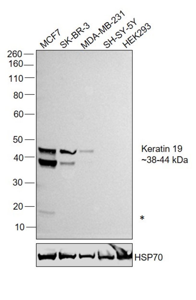 Cytokeratin 19 Monoclonal Antibody (BA17), Invitrogen 500 μL ...