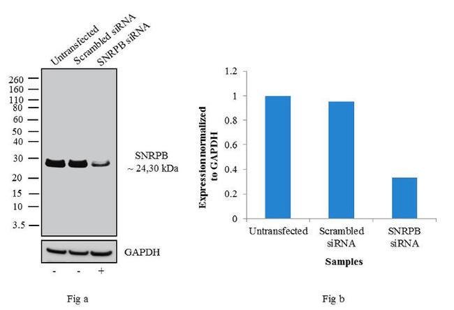 SNRPB Monoclonal Antibody (Y12), Invitrogen 500 μL; Unconjugated ...
