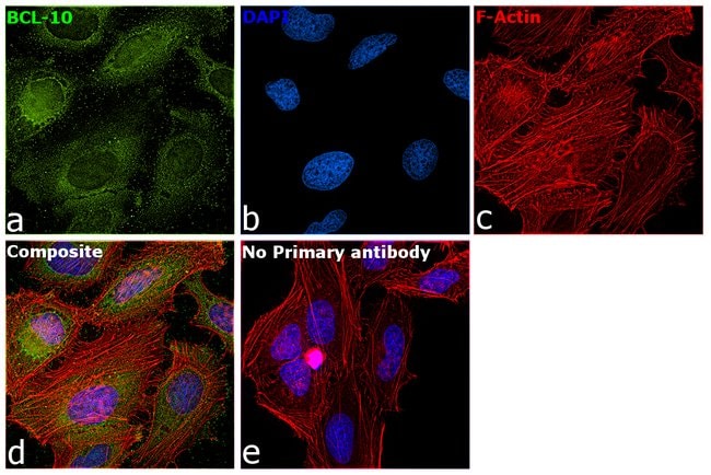 Invitrogen Bcl-10 Monoclonal Antibody (4F8) 100 μL; Unconjugated:Antibodies, | Fisher Scientific