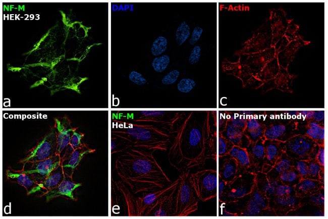 NEFL Monoclonal Antibody (T.400.5), Invitrogen 100 μL; Unconjugated ...