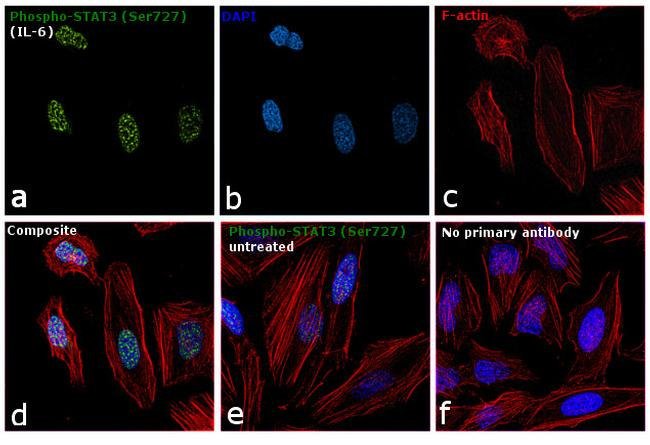 Phospho-STAT3 (Ser727) Monoclonal Antibody (E.35.9), Invitrogen™ 100 μL; Unconjugated | Fisher ...