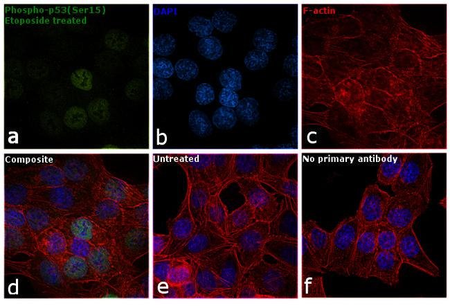 Phospho-p53 (Ser15) Monoclonal Antibody (C.381.0), Invitrogen 100 μL ...