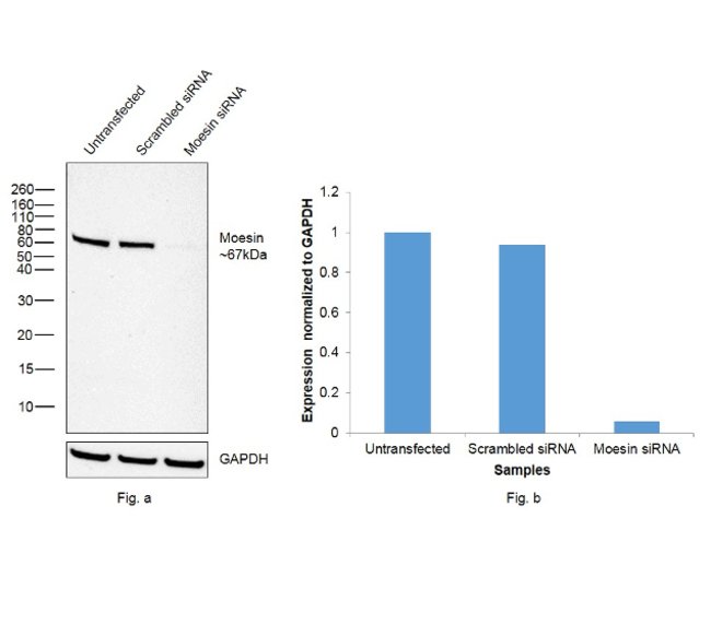 Invitrogen Moesin Monoclonal Antibody (2C12) 100 μg; Unconjugated:Anticuerpos | Fisher Scientific