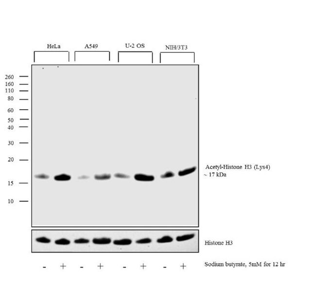 H3K4ac Recombinant Rabbit Monoclonal Antibody (RM149), ChIP-Verified ...