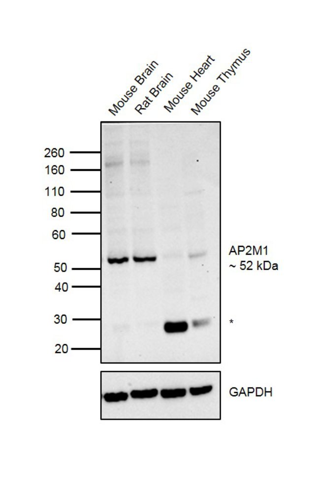 AP2M1 Monoclonal Antibody (OTI 2F11), Invitrogen 100 μL; Unconjugated ...