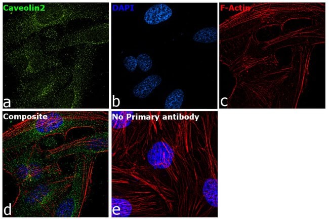 Invitrogen Caveolin 2 Recombinant Rabbit Monoclonal Antibody (SY22-05 ...