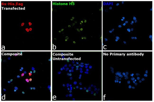 Invitrogen 6x-His Tag Recombinant Rabbit Monoclonal Antibody (RM146 ...