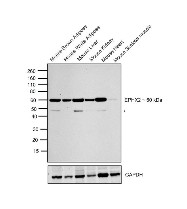 EPHX2 Recombinant Rabbit Monoclonal Antibody (JE64-07), Invitrogen 100 ...