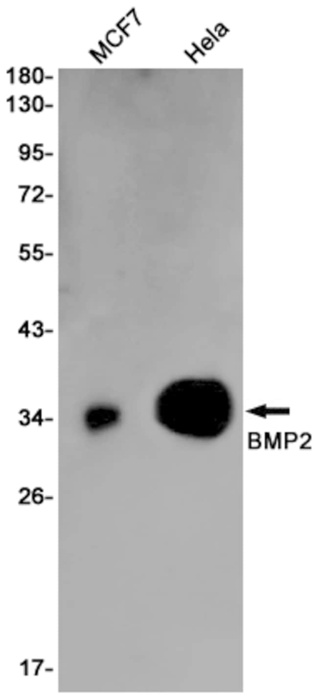 Invitrogen BMP-2 Recombinant Rabbit Monoclonal Antibody (K01_1N59) 100 ...