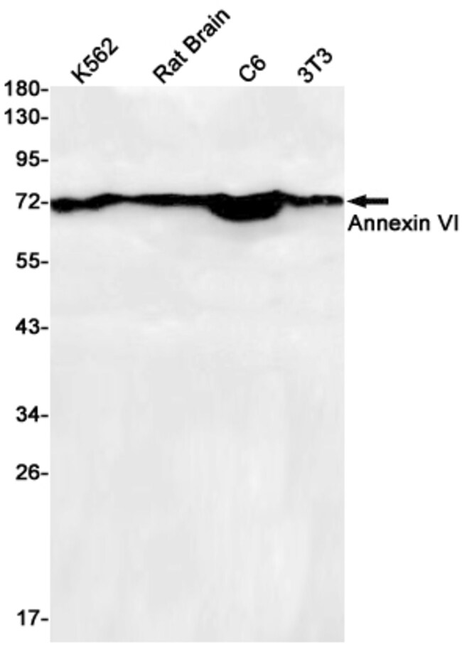 Invitrogen Annexin A6 Recombinant Rabbit Monoclonal Antibody (K01_1M79 ...