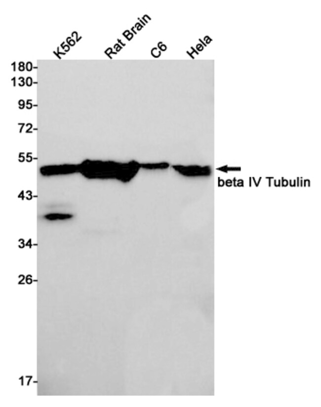 Invitrogen beta-4 Tubulin Recombinant Rabbit Monoclonal Antibody (K01 ...