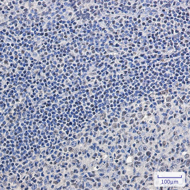 Invitrogen SRSF2 Recombinant Rabbit Monoclonal Antibody (K01_1Y11) 50 ...