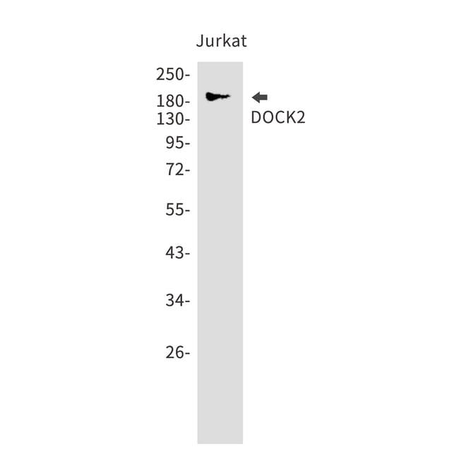 Invitrogen DOCK2 Recombinant Rabbit Monoclonal Antibody (K01_1Q51) 100 ...