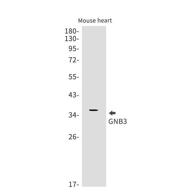 Invitrogen GNB3 Recombinant Rabbit Monoclonal Antibody (K01_1R86) 50 μL ...