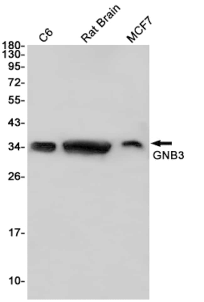 Invitrogen GNB3 Recombinant Rabbit Monoclonal Antibody (K01_1R86) 50 μL ...