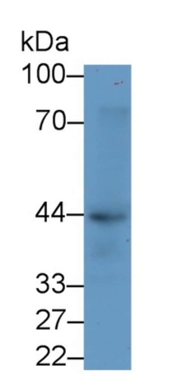 Invitrogen SIGLEC8 Monoclonal Antibody (D3) 200 μL | Buy Online ...