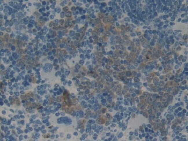 Invitrogen SERPINB2 Monoclonal Antibody (A10) 200 μL | Buy Online ...
