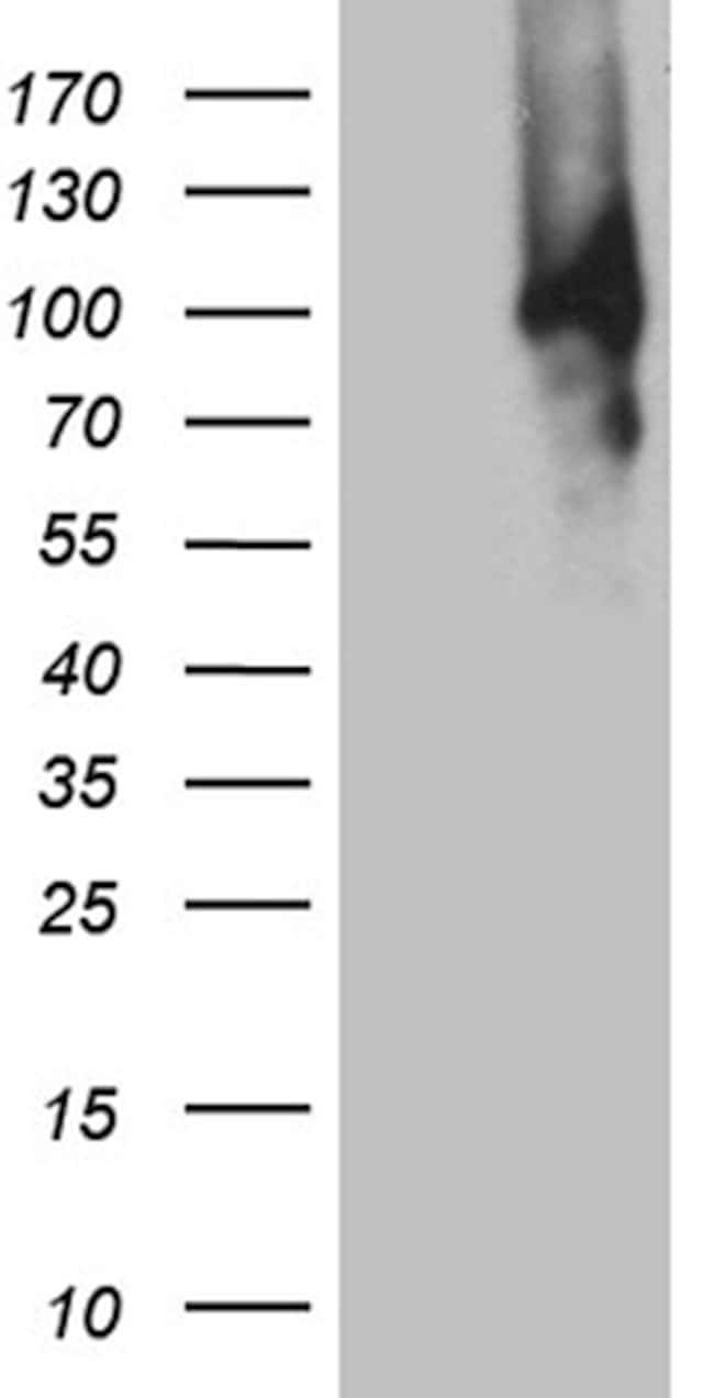 MUM1 Monoclonal Antibody (OTI4E1), TrueMAB , OriGene 100 μL ...