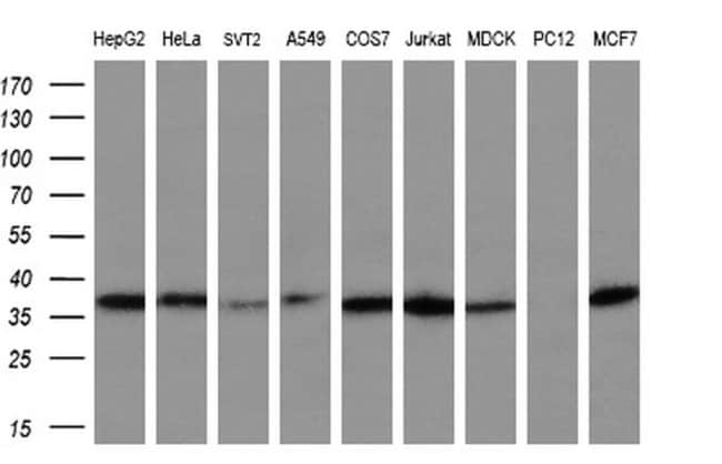 NR0B2 Monoclonal Antibody (OTI8E5), TrueMAB , OriGene 100 μL ...