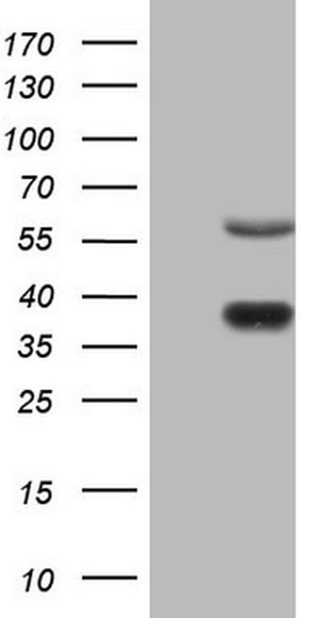 NR1D2 Monoclonal Antibody (OTI5C6), TrueMAB , OriGene 100 μL ...