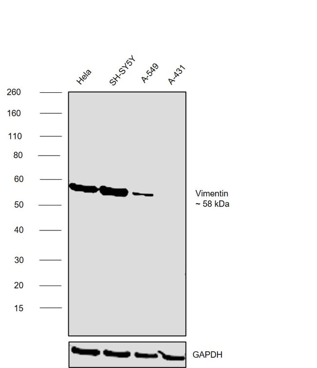 Invitrogen Vimentin Monoclonal Antibody (RV202) 100 μL; Unconjugated:Antikroppar | Fisher Scientific