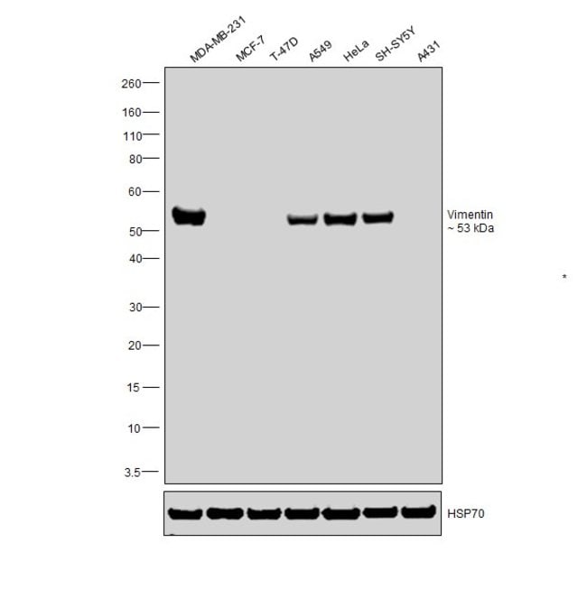 Invitrogen Vimentin Monoclonal Antibody (RV202) 100 μL; Unconjugated:Antikroppar | Fisher Scientific