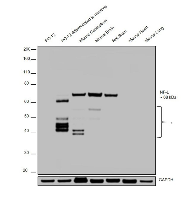 NEFL Polyclonal Antibody, Invitrogen 100 μL; Unconjugated:Antibodies, | Fisher Scientific
