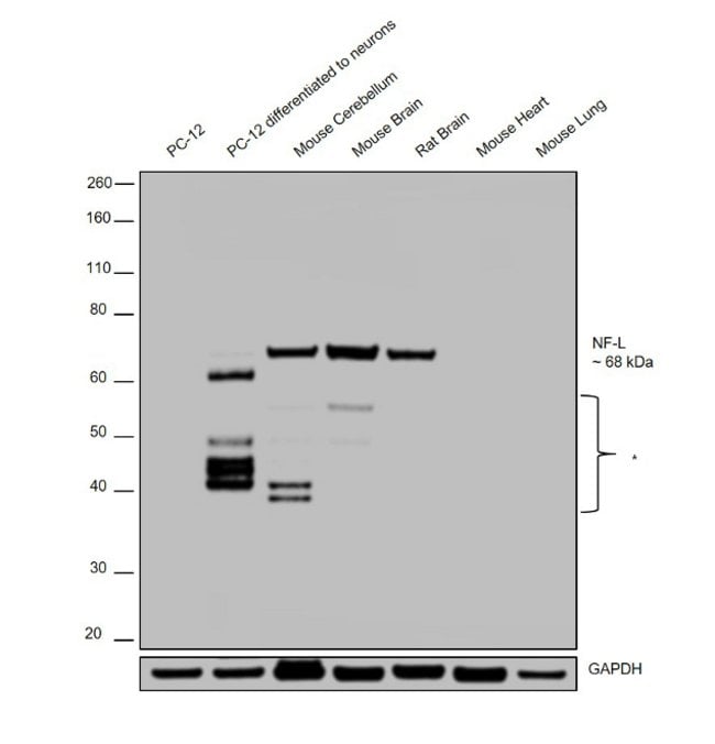 Invitrogen NEFL Polyclonal Antibody 100 μL; Unconjugated:Antibodies ...