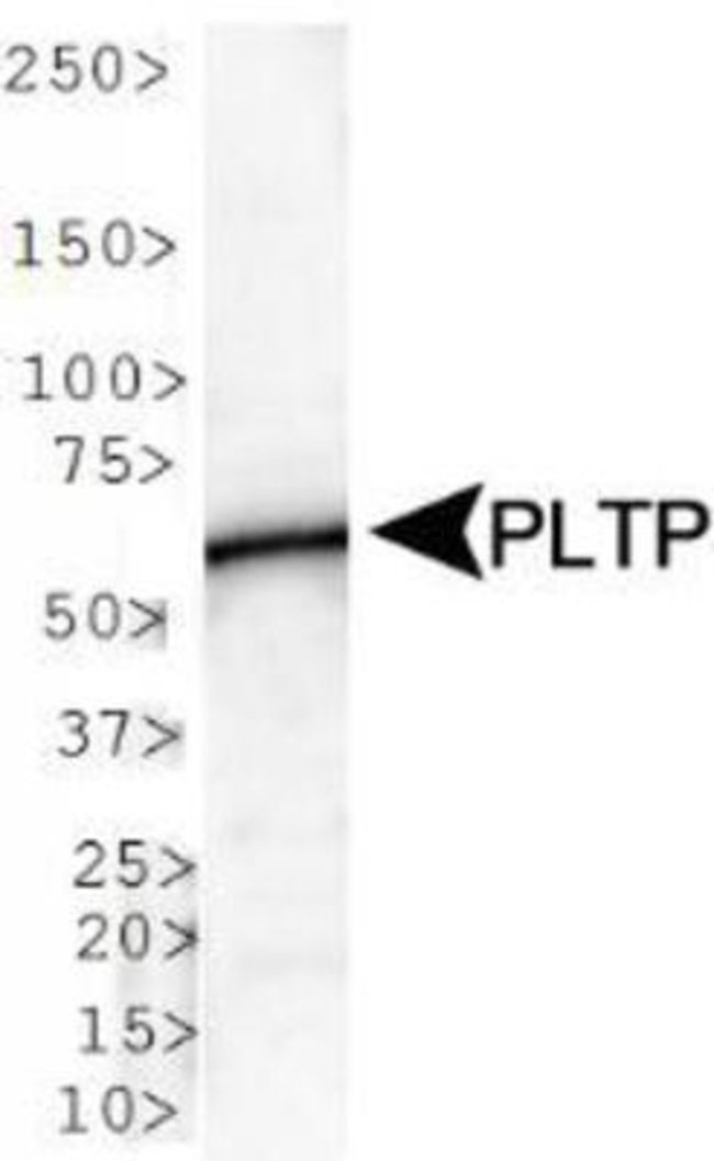 Invitrogen PLTP Polyclonal Antibody 200 μL; Unconjugated:Antibodies ...