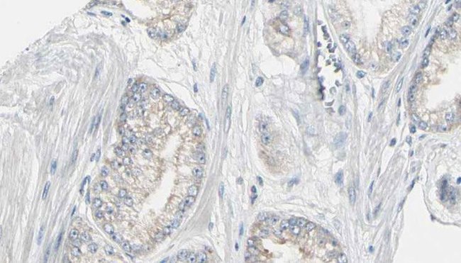 PYGL Polyclonal Antibody, Invitrogen 100 μL; Unconjugated:Antibodies ...