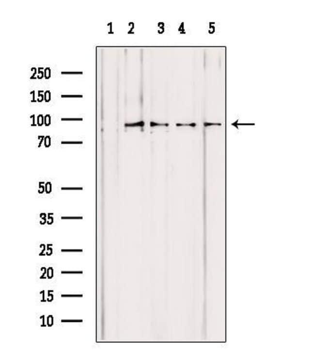 PYGL Polyclonal Antibody, Invitrogen 100 μL; Unconjugated:Antibodies ...