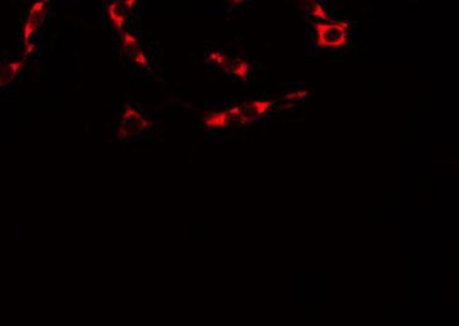 KAL1 Polyclonal Antibody, Invitrogen™ 100 μL; Unconjugated | Fisher ...